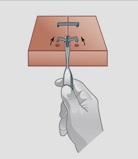 Removing Sutures and Staples ~ Nursing