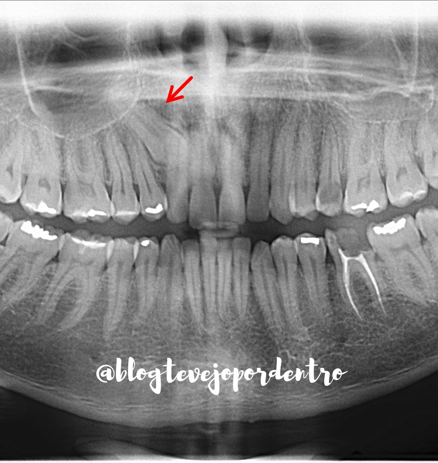 "Te vejo por dentro": Canino incluso