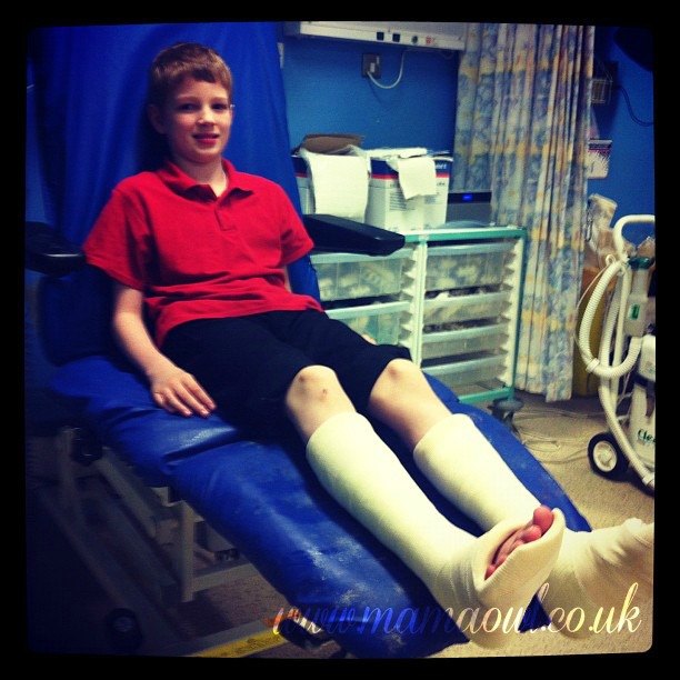 Mama OWL Blog: Goodbye Leg Casts - #R2BC