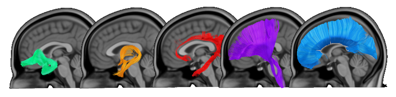 Diffusion Imaging; Introduction, tutorials and background on diffusion tensor imaging and techniques