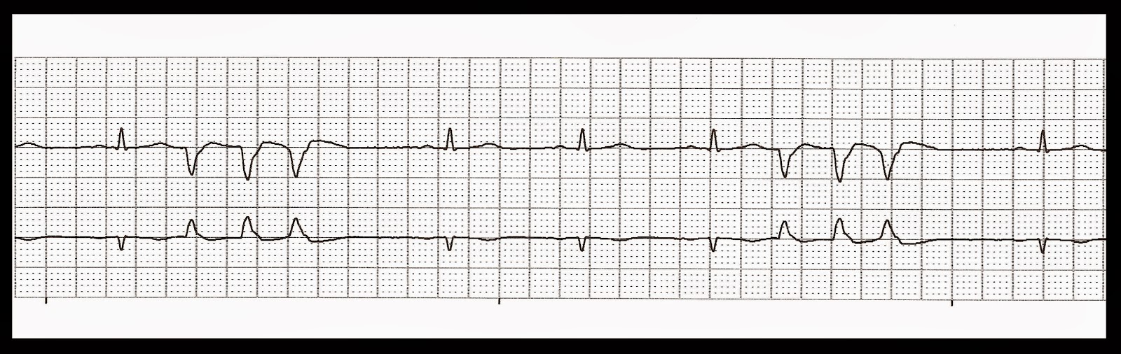 Float Nurse: Practice EKG Strips 350