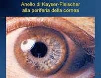 Medicina Funzionale & Lifestyle Clinic: EPIDEMIA DI TOSSICITA’ DA RAME ...