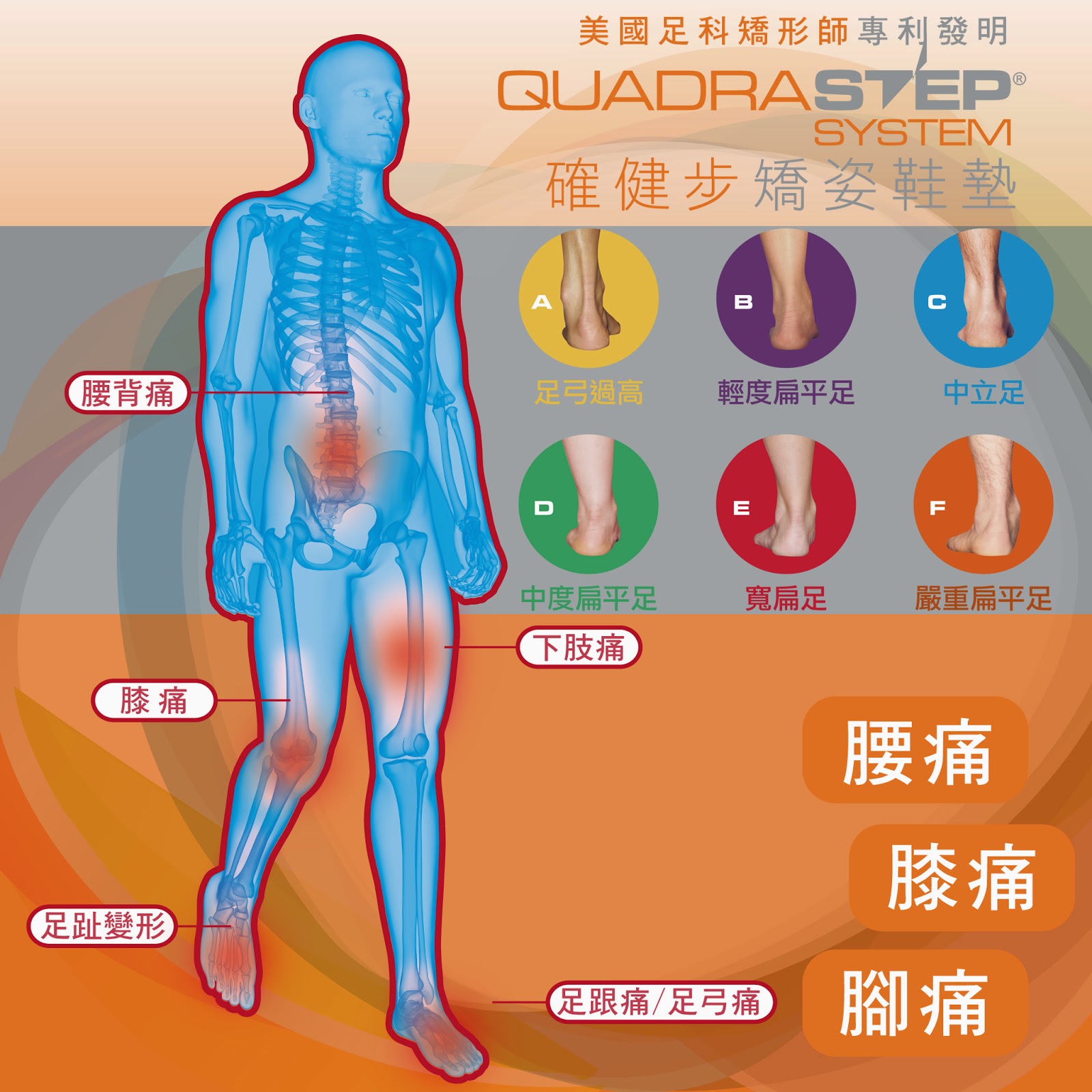 Medimart樂康軒-健康知識Blog: 超抵買的矯正鞋墊 有效對付足患Quadrastep