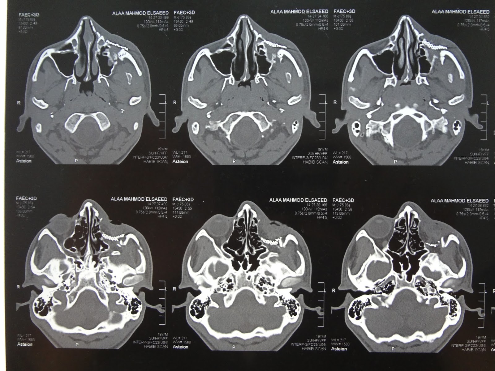 radiology ENT, Maxillofacial, Head and neck, neurosurgery, Dentology ...