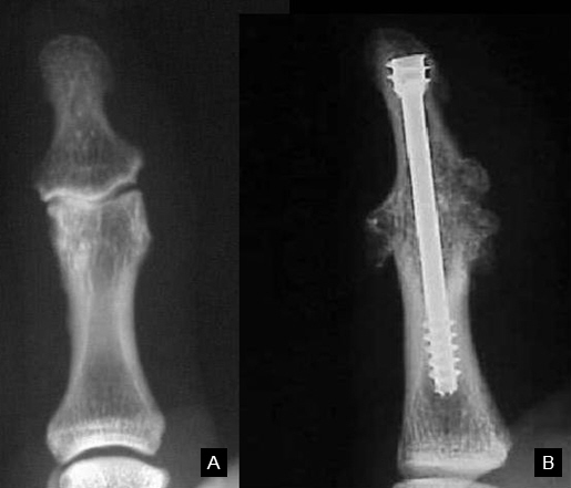 TRAUMATOLOGÍA DE LA MANO