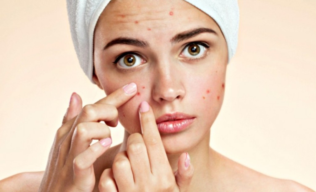 AIIMS Trained Top Dermatologist in Delhi: Most Common Skin Problems and ...
