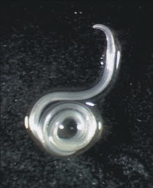 Nuestro cuerpo: Hogar de parásitos: Anisakis spp.