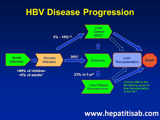 What is HBV Disease Progression