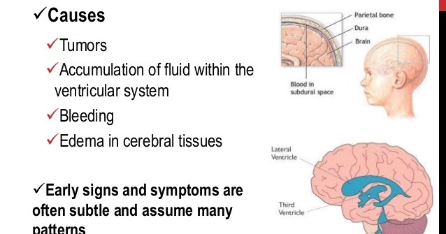 Pediatrics Notes: Managing A Child With Raised Intracranial Pressure