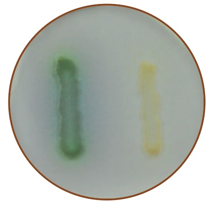 [Microbiology] Pseudomonas Isolation Agar | Free Medical Atlas