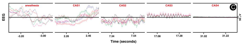 The Neurocritic: August 2013