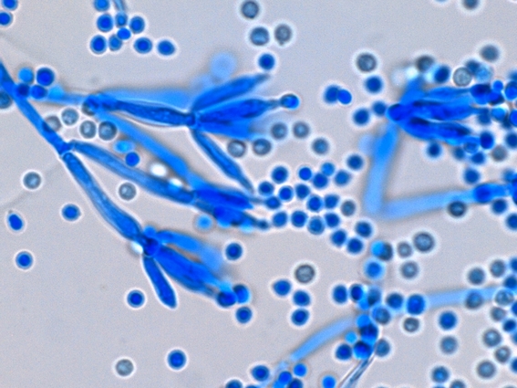 Fun With Microbiology (What's Buggin' You?): Penicillium citrinum