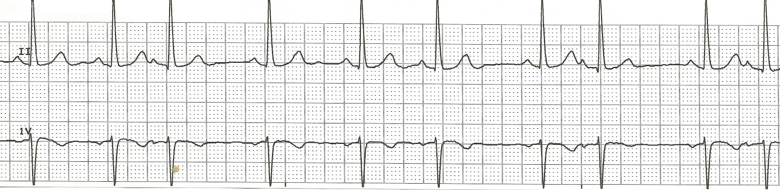 ECG Rhythm Strips 80