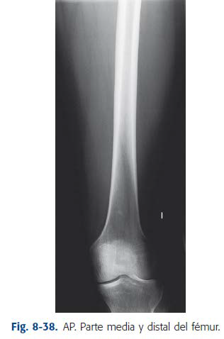 PRODUCCION Y TRATAMIENTO DE IMAGENES DIAGNOSTICAS: CAPITULO FEMUR Y ...