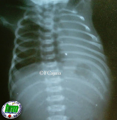 Dr. Frank Cajina Gómez: Atlas de Defectos Congénitos HECAM