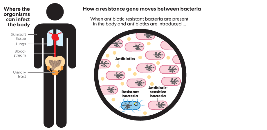 Environmental Health 320 2012F: Carbapenem-Resistant Enterobacteriaceae ...