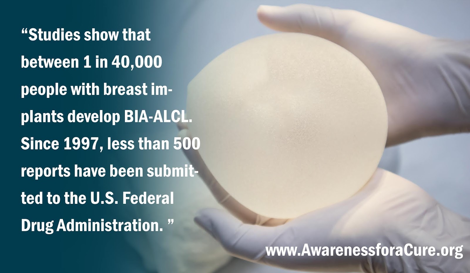 Breast Cancer Community News: Cancer Alert: Breast Implant Associated ...