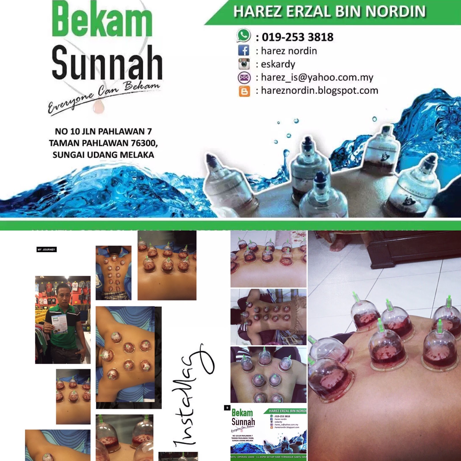 Rawatan Bekam