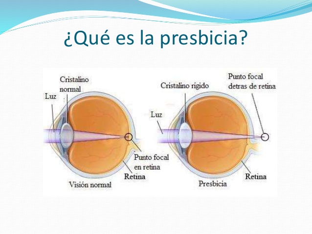 BLOG DE OPTICA CONFORVISION: ¿Presbicia?