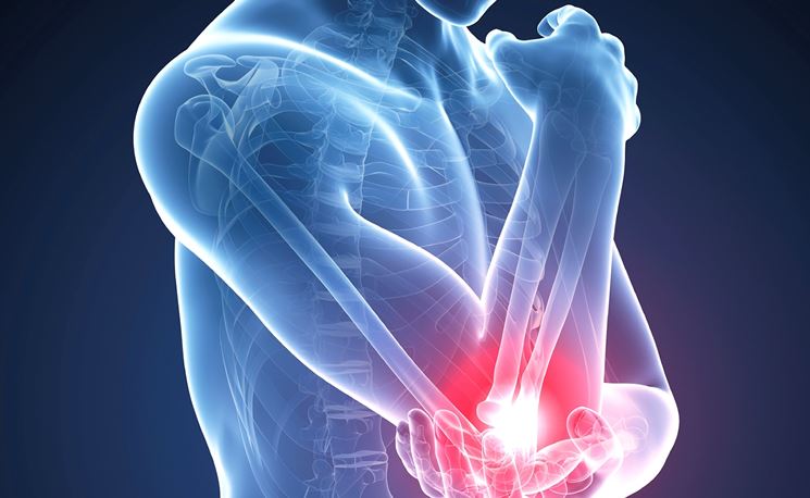 ®FisioRiab : L'epicondilite: tutto quello che bisogna sapere.