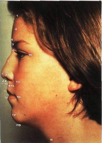 Dentistry lectures for MFDS/MJDF/NBDE/ORE: Note on Radiographic Anatomy ...