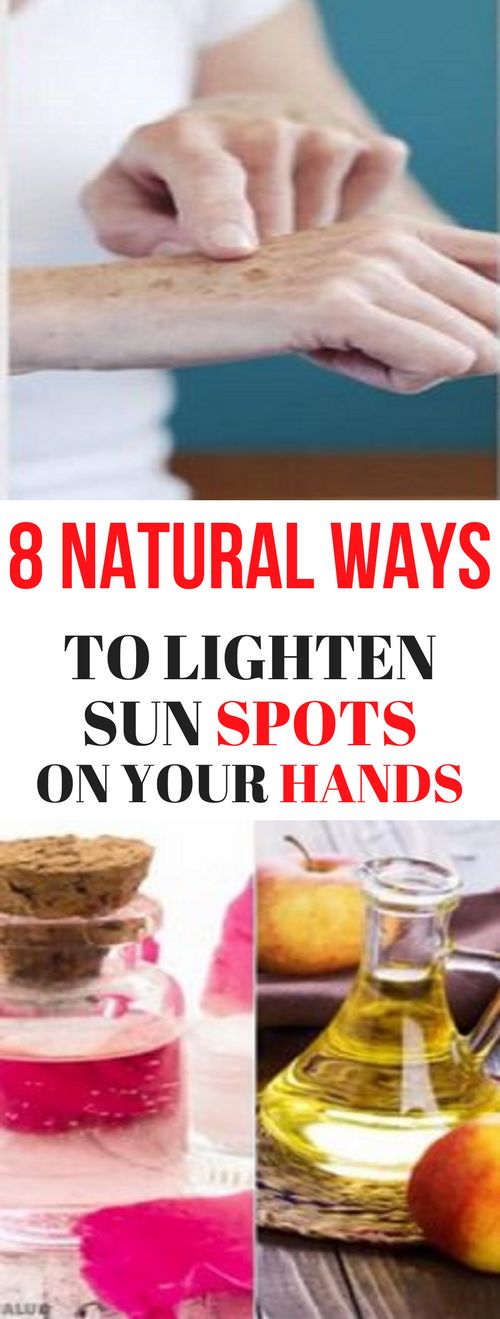 8 NATURAL WAYS TO LIGHTEN SUN SPOTS ON YOUR HANDS - HEALTH CAPLET