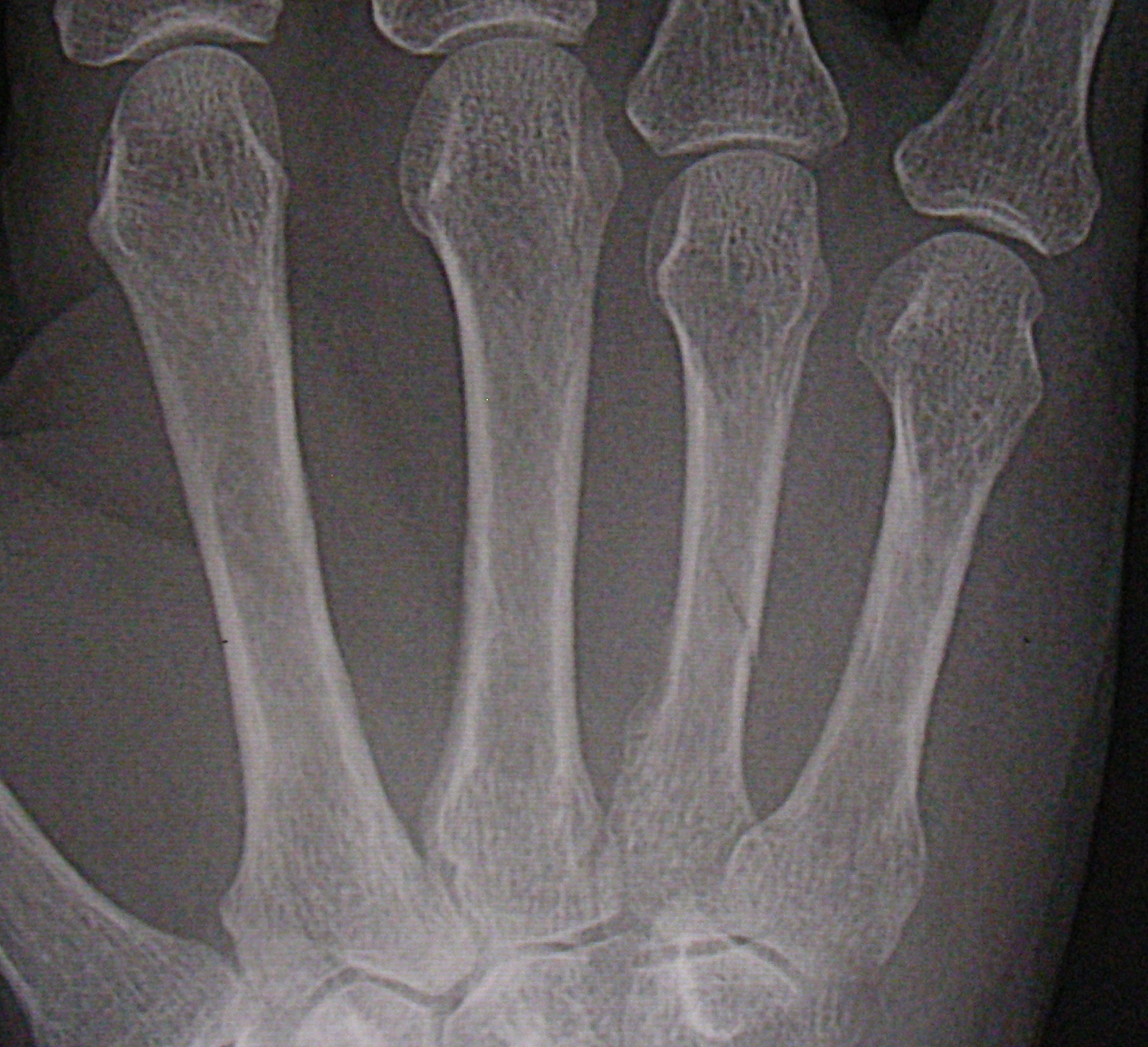 IK KAN VLIEGEN...: Gips