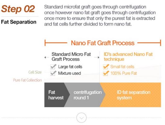 ID Hospital Korea: ID Hospital's NANO Fat Graft