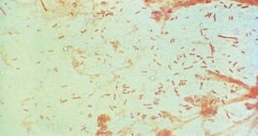 [Microbiology] Atlas of Nonfermenting and Miscellaneous Gram-Negative ...