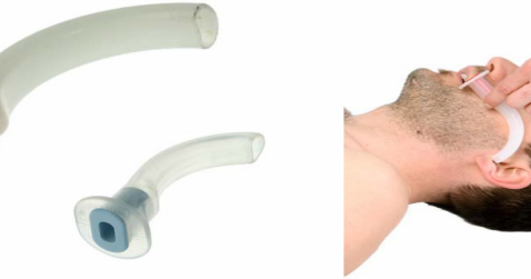 AMG: F10-Aplicarea pipei Guedel