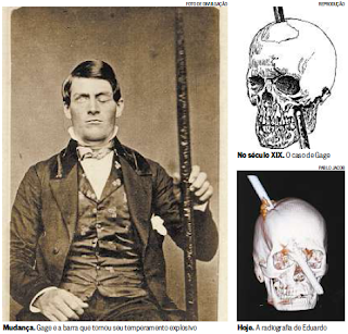 A triste história de Phineas Gage - Jornal GGN