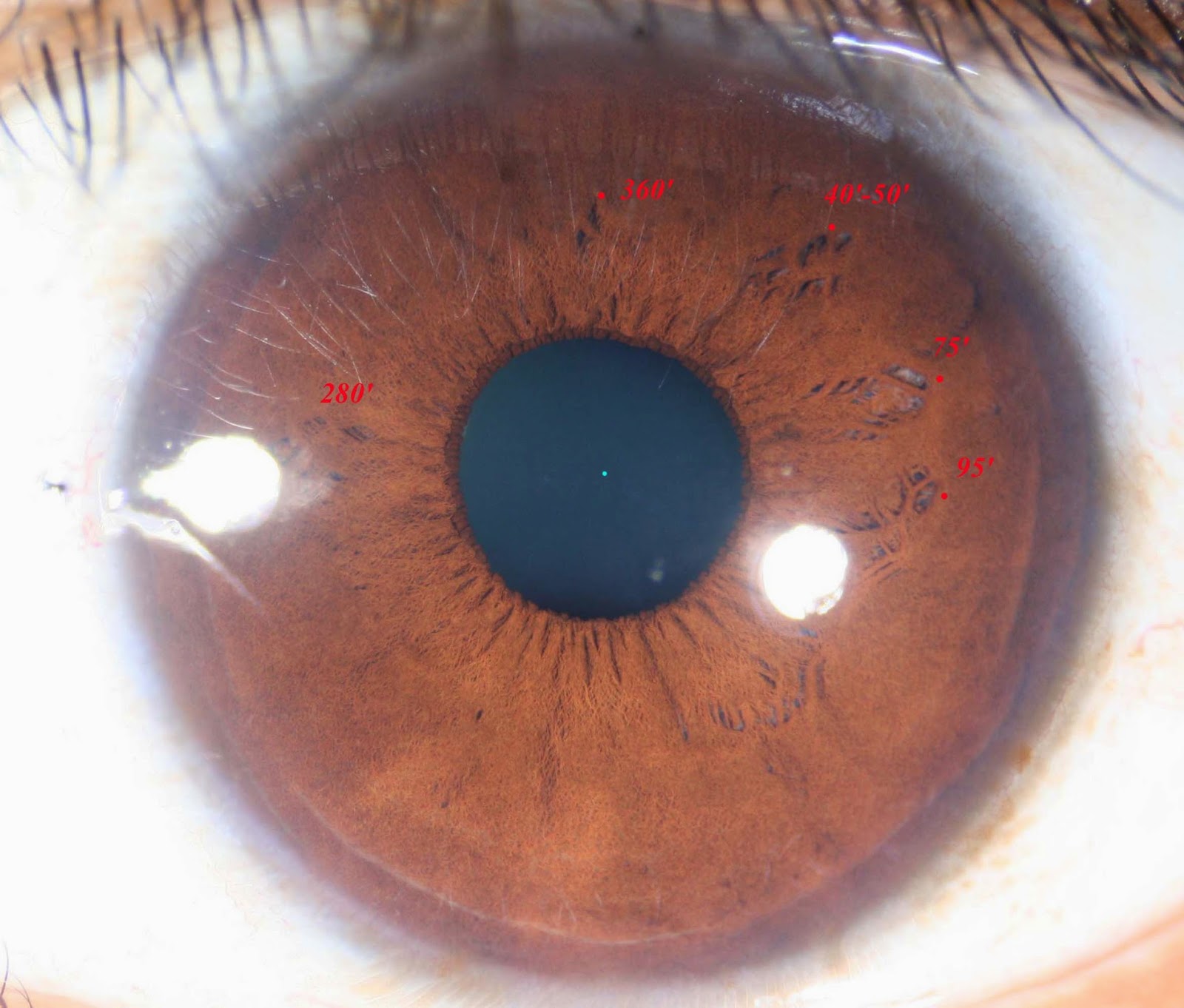 Modern & Multidimensional Iridology: "Inside-Out" - Starting From ...