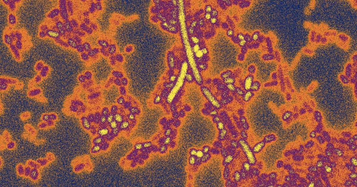 The birth of Modern Man: Microverse- To survive in the human gut ...