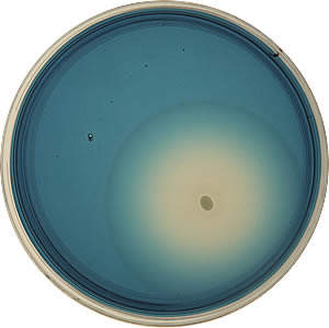 MEDIA PERTUMBUHAN MIKROBA | YANJUZ