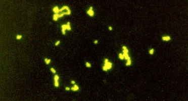 Say Hi to "Methanogens in human flora"