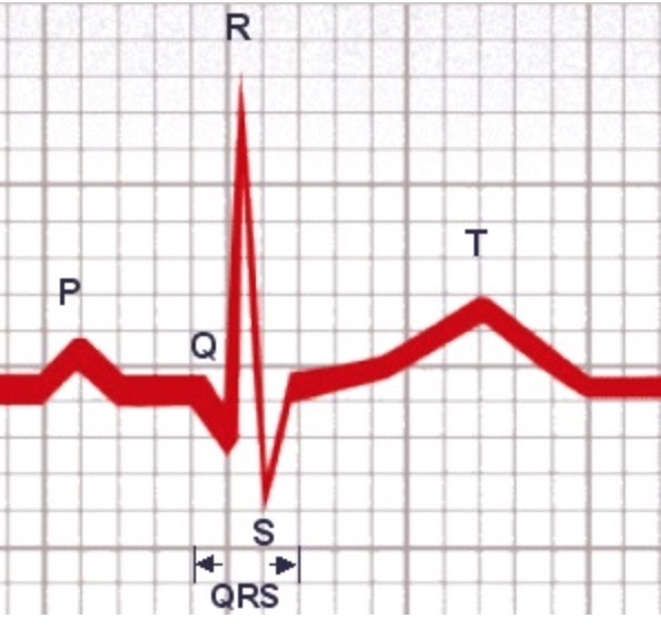 Dr David Grimes: A simple view of the ECG