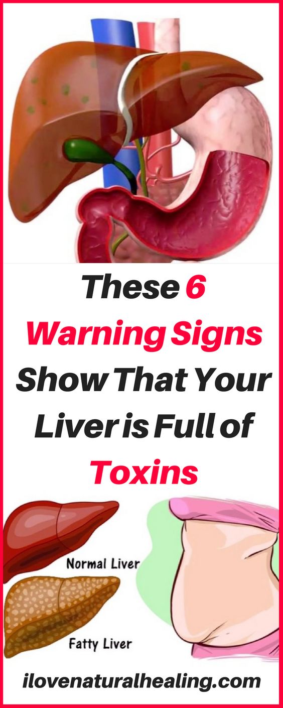 6 Signs That Your Liver Is Full Of Toxins Fitness Fiesta