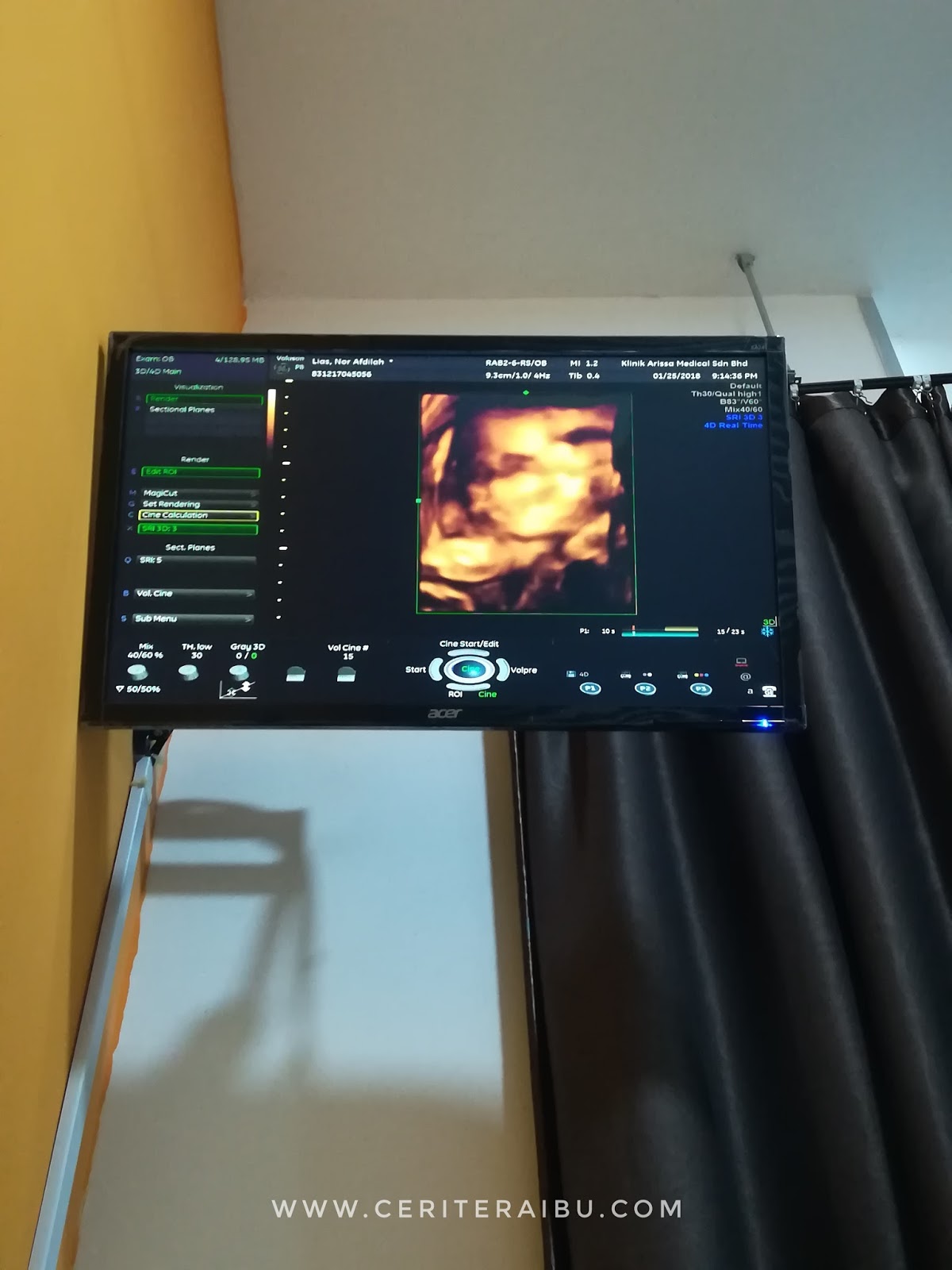 Klinik Untuk Scan Baby Di Pasir Gudang