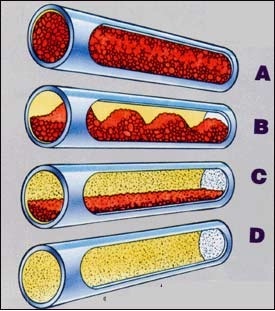 PNEUMATIC CONVEYING SYSTEM | gustavegunawan