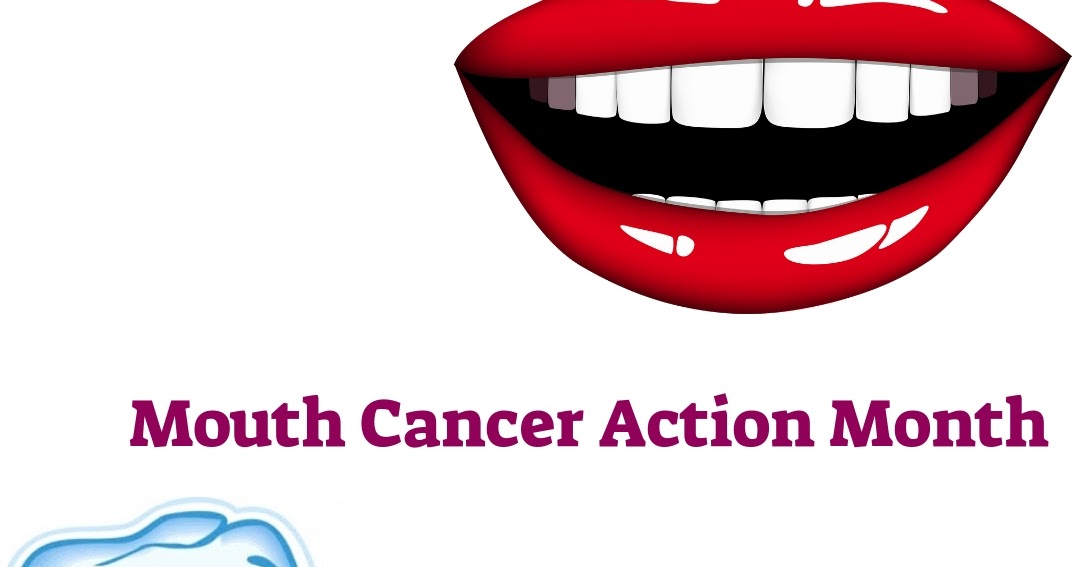 Pathology Meet 2019: NOVEMBER – MOUTH CANCER ACTION AWARENESS MONTH