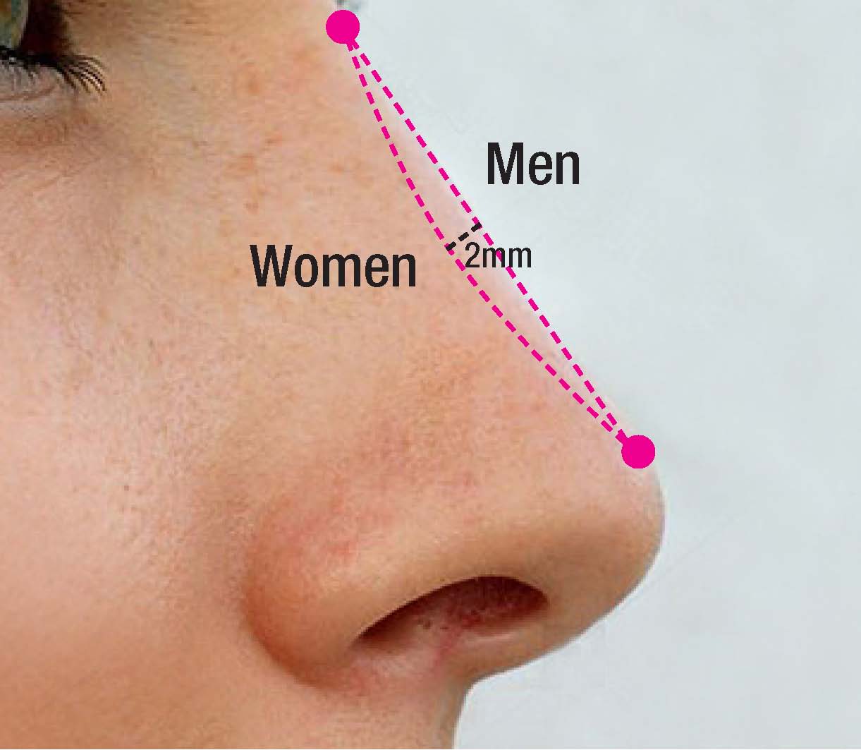 Plastic and Cosmetic Surgery: The Science of Beauty - What Makes A ...