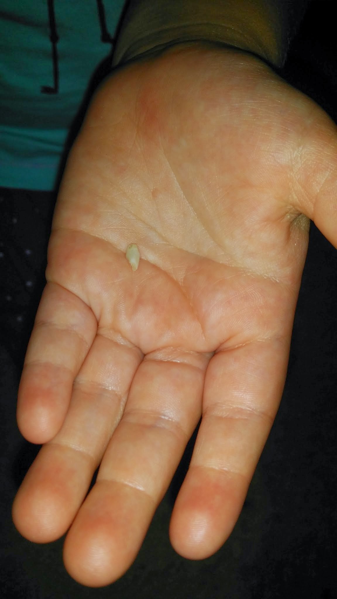 Mother of a Toddler and Triplets Plus ONE: Ava lost her 1st tooth today ...