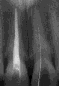 Dentistry and Medicine: Preparation of the Root canal System ...