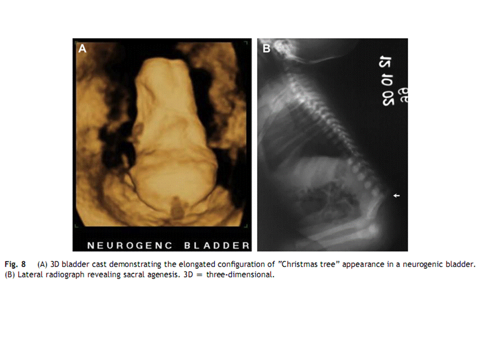 BÀI SOẠN VỀ SIÊU ÂM CHẨN ĐOÁN: VIRTUAL CYSTOSCOPY USING 3D ULTRASOUND