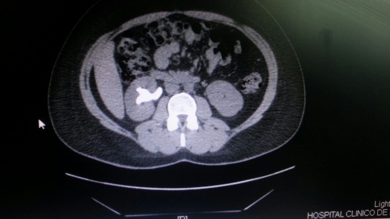 Urologia paso a paso