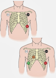 Basic ECG Interpretation ~ Nursing