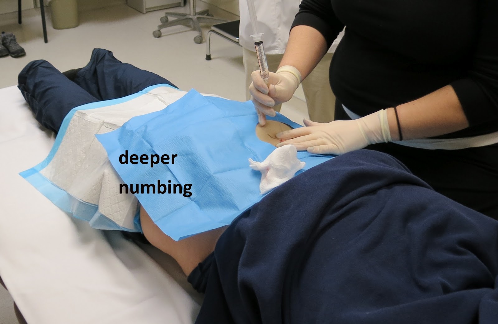 jm's Adventure with Multiple Myeloma: Bone Marrow Biopsy # 5 - WARNING ...