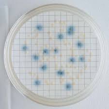 Membrane Filter Technique | Membrane Filtration Method (Microbes ...