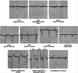 ER goldbook: Emergency cardiac pacing