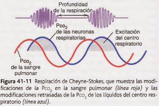 Casi-Paramédico: Mecanismo básico de la respiración de Cheyne-Stokes